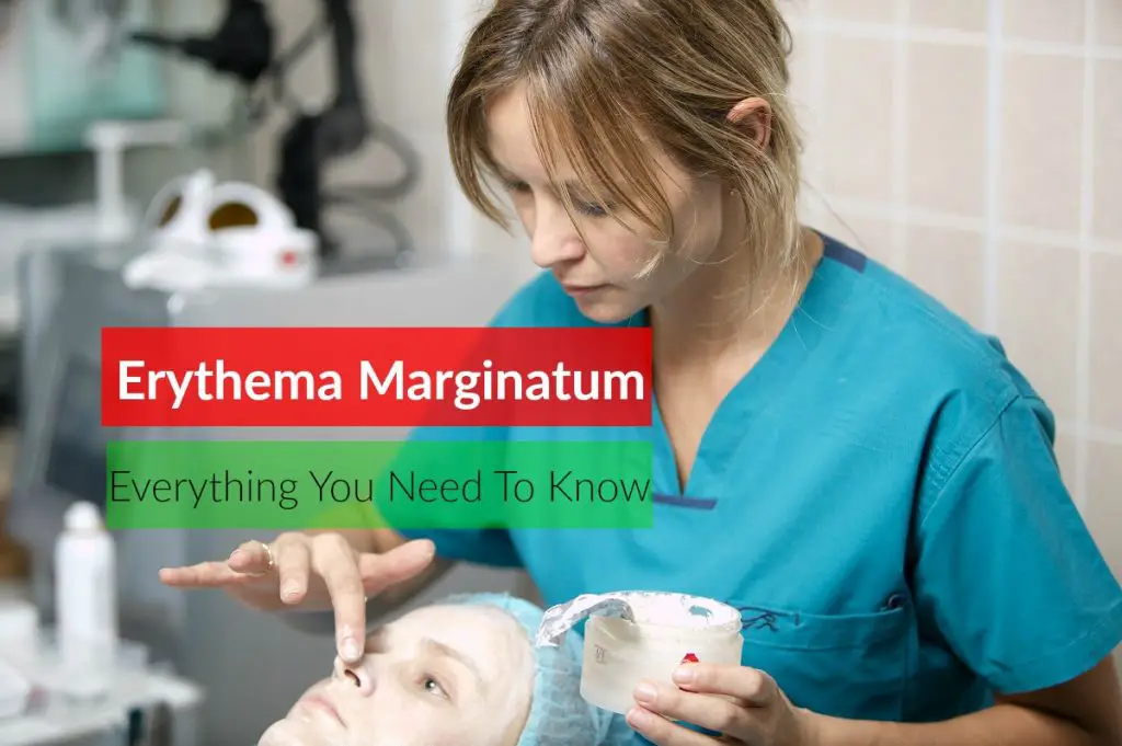 Erythema Marginatum - Everything You Need To Know - The Healthy Apron