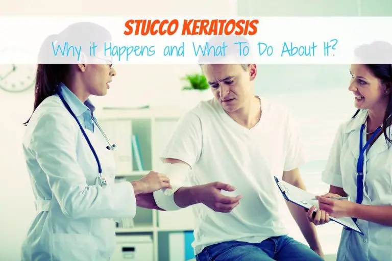 Stucco Keratosis - Why it Happens and What To Do About It?