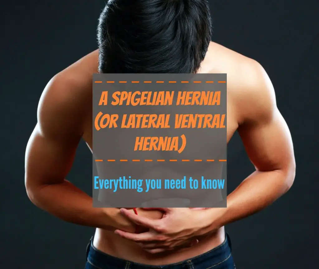 A Spigelian hernia (or lateral ventral hernia) - Everything you need to ...