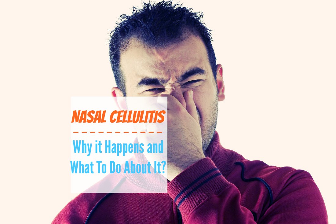 Nasal Cellulitis Why It Happens And What To Do About It The Nasal Cellulitis Why It Happens And What To Do About It The