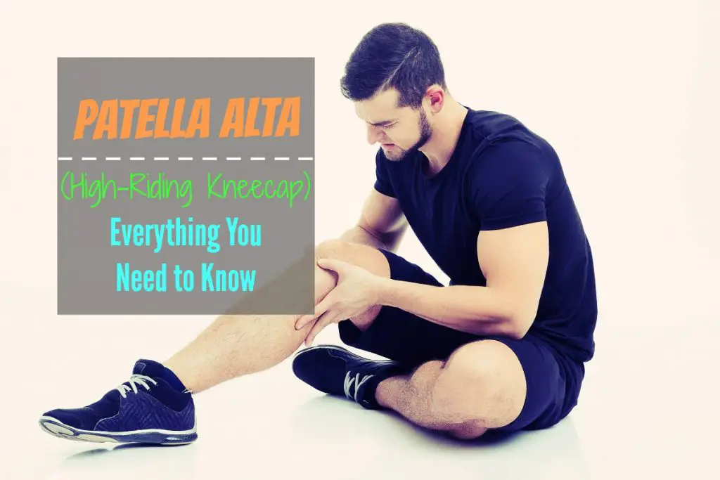 Patella Alta (High-Riding Kneecap) - Everything You Need to Know - The ...