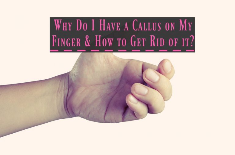Why Do I Have a Callus on My Finger & How to Get Rid of it? - The ...